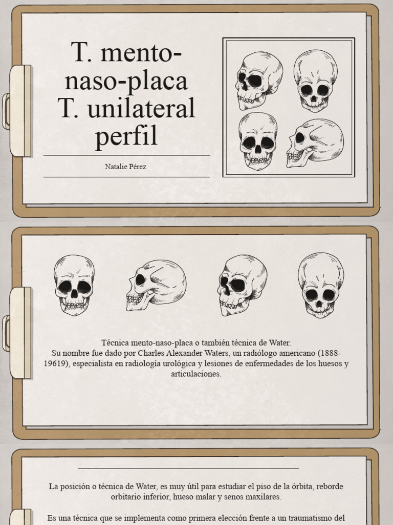 Técnica Mento-Naso-Placa en Radiología | PDF | Cabeza y cuello humanos ...