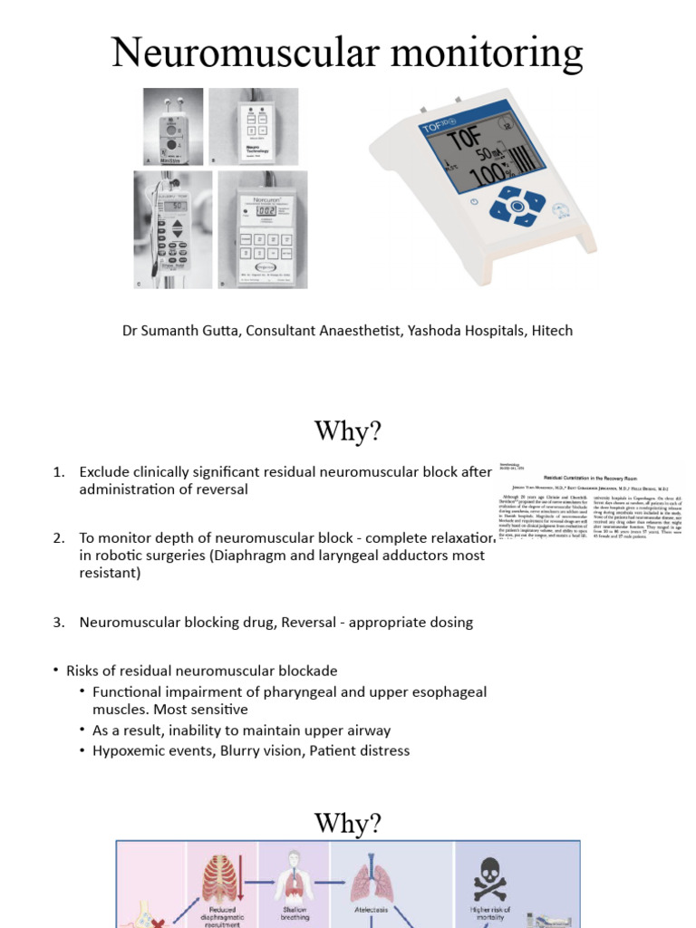 Neuromuscular Monitoring | PDF | Muscle Contraction | Medical Specialties