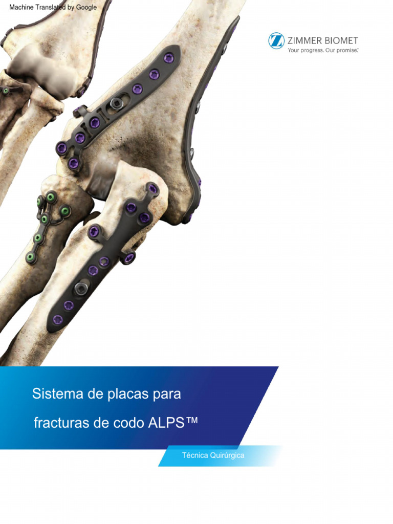 Alps Elbow Fracture Plating System Surgical Technique 2 | PDF | Codo ...