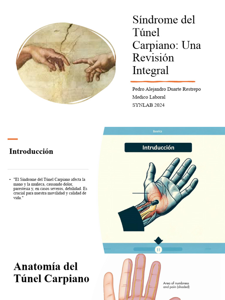 Síndrome del Túnel Carpiano: Guía Completa | PDF | Síndrome del túnel ...