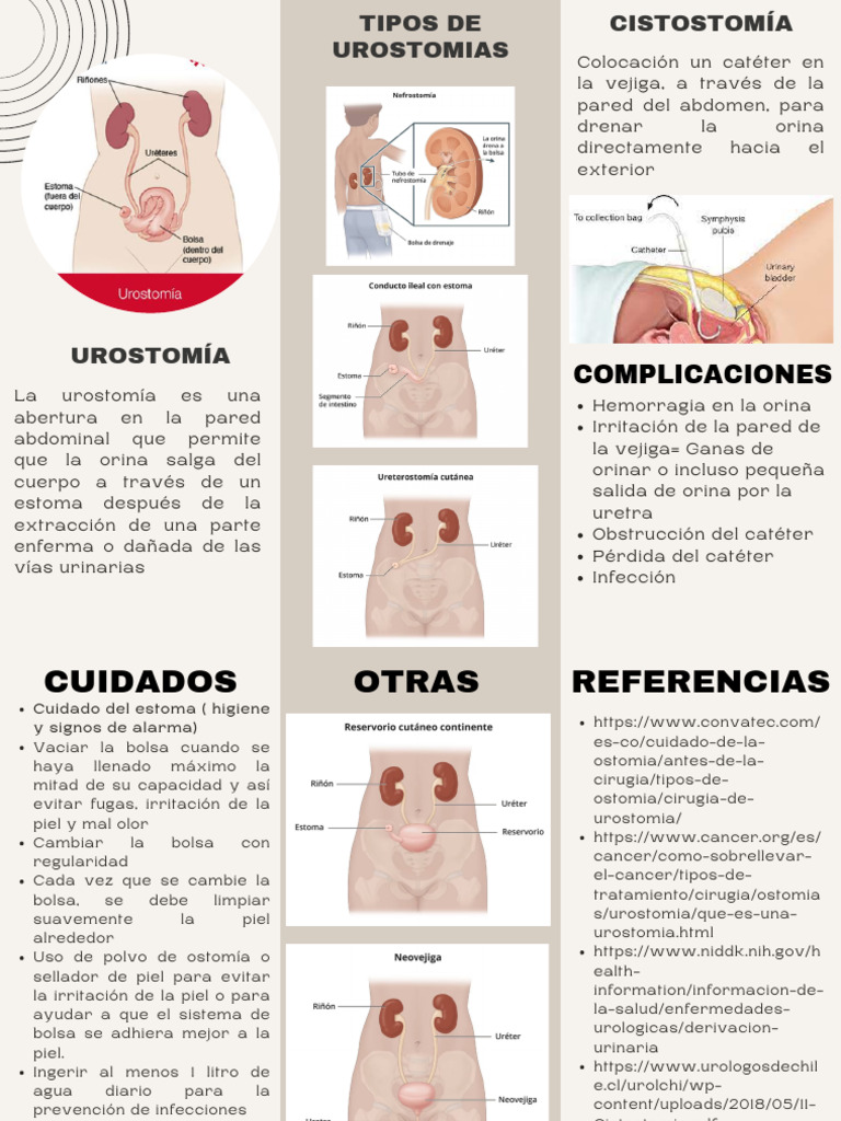 Urostomía | PDF | Sistema genitourinario | Enfermedades y trastornos