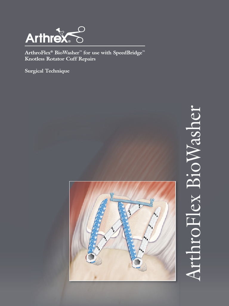 Arthroflex Biowasher For Use With Speedbridge Knotless Rotator Cuff ...