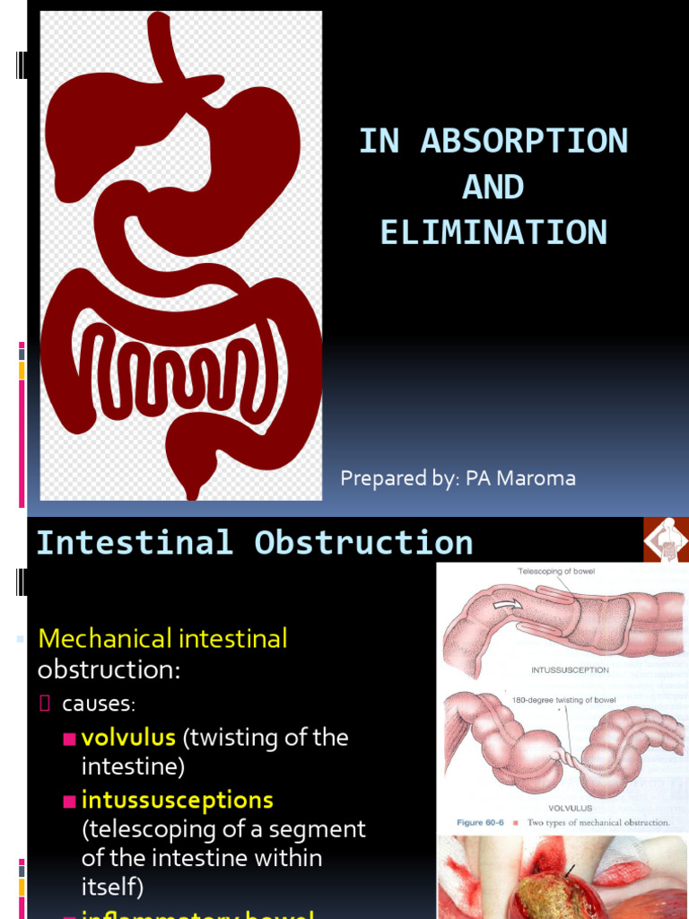 Week2 Lgit | Download Free PDF | Hemorrhoid | Crohn's Disease