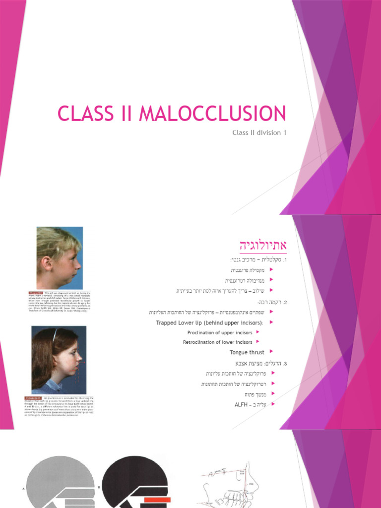Class II Division 1 Malocclusion | PDF