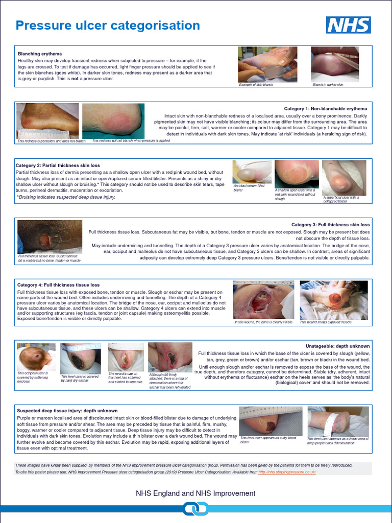 Pressure Ulcer Categorisation Poster | PDF | Skin | Wound