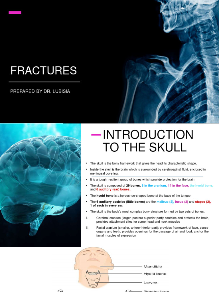 Fractures Part One | PDF | Skull | Musculoskeletal System