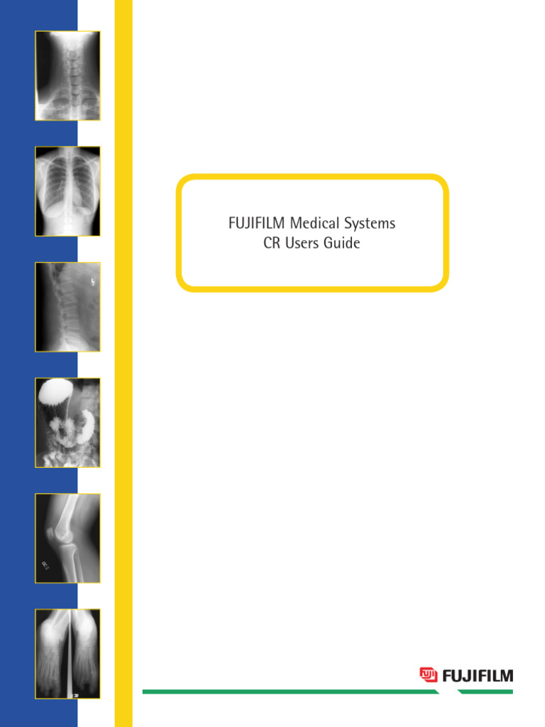 CR Users Guide | PDF | Exposure (Photography) | Contrast (Vision)