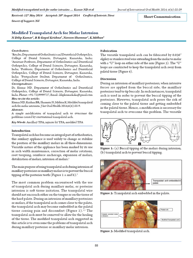 Modified Transpalatal Arch for Molar Intrusion | PDF | Mouth ...