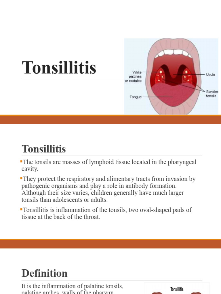 Tonsillitis | PDF | Medical Specialties | Diseases And Disorders