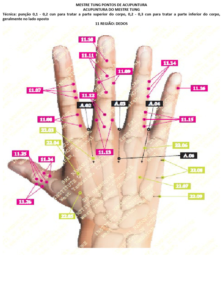 Mestre Tung Pontos de Acupuntura - Completo | PDF | Acupuntura | Artrite