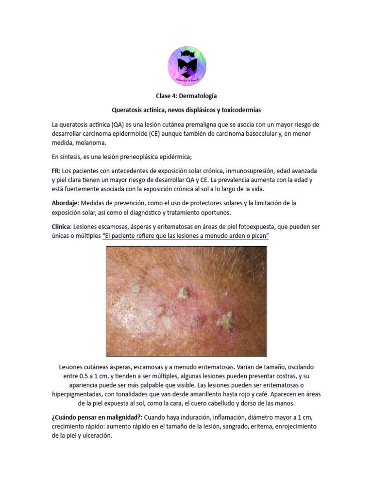 Queratosis Actínica, Nevos Displásicos y Toxicodermias (Exanetema ...