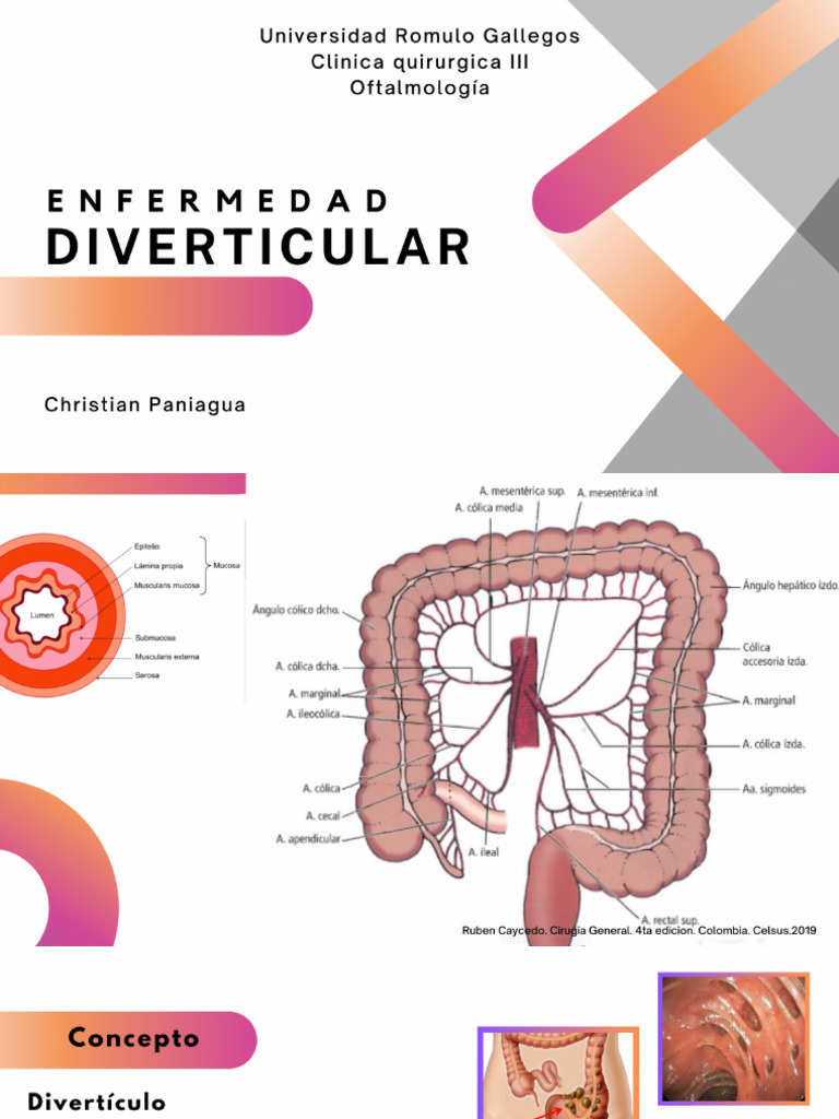 Enf diverticular | PDF