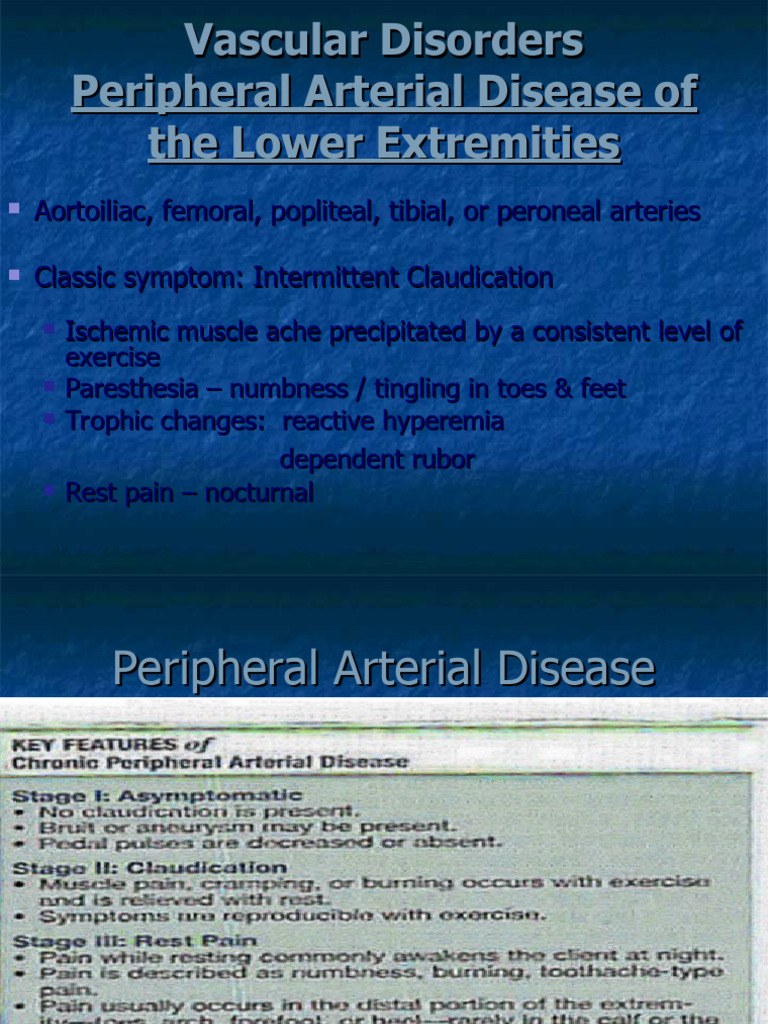 Aortoiliac, Femoral, Popliteal, Tibial, or Peroneal Arteries Classic ...