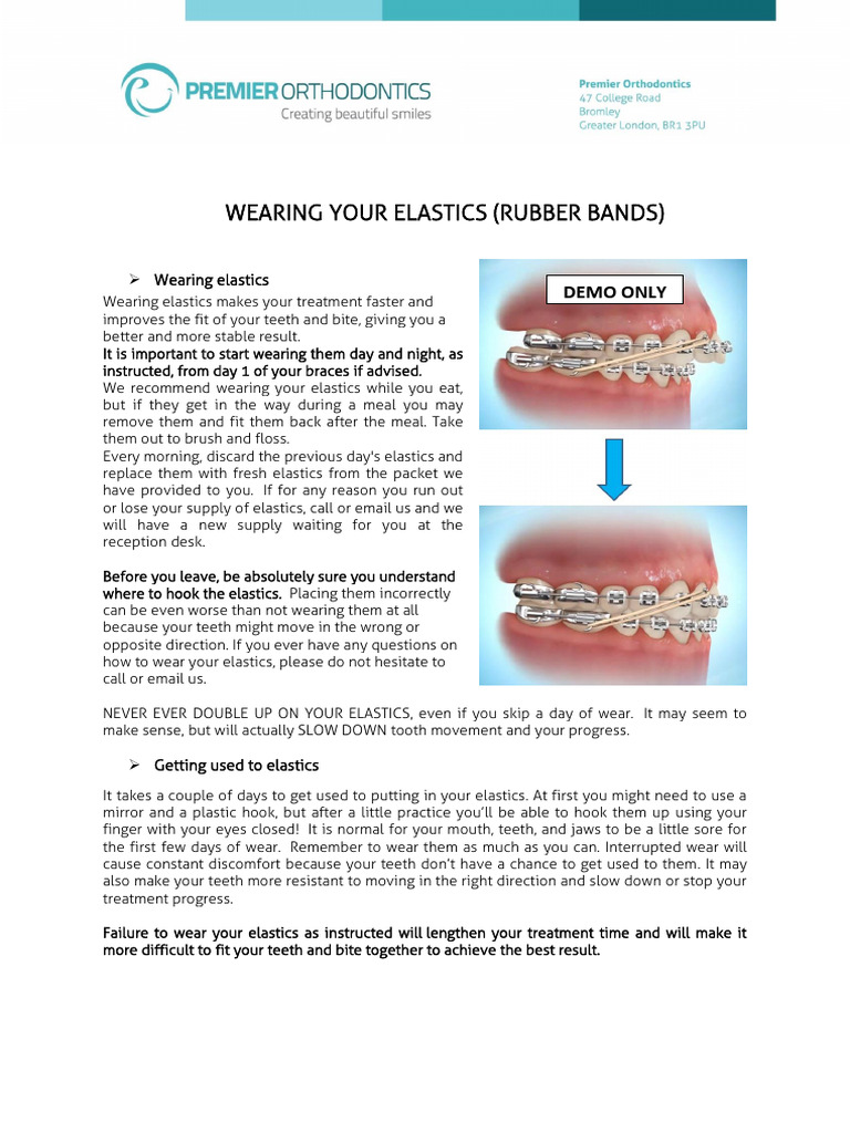 Wearing Elastics for PDF | PDF