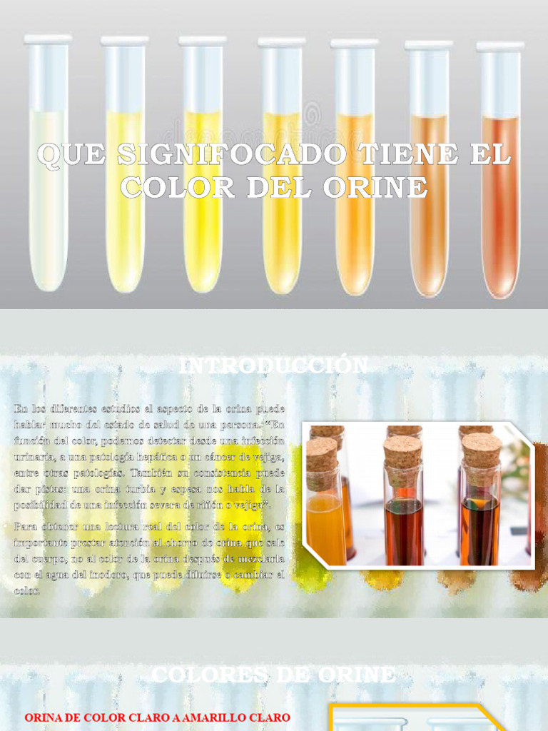 Color Del Orine | PDF | Orina | Riñón