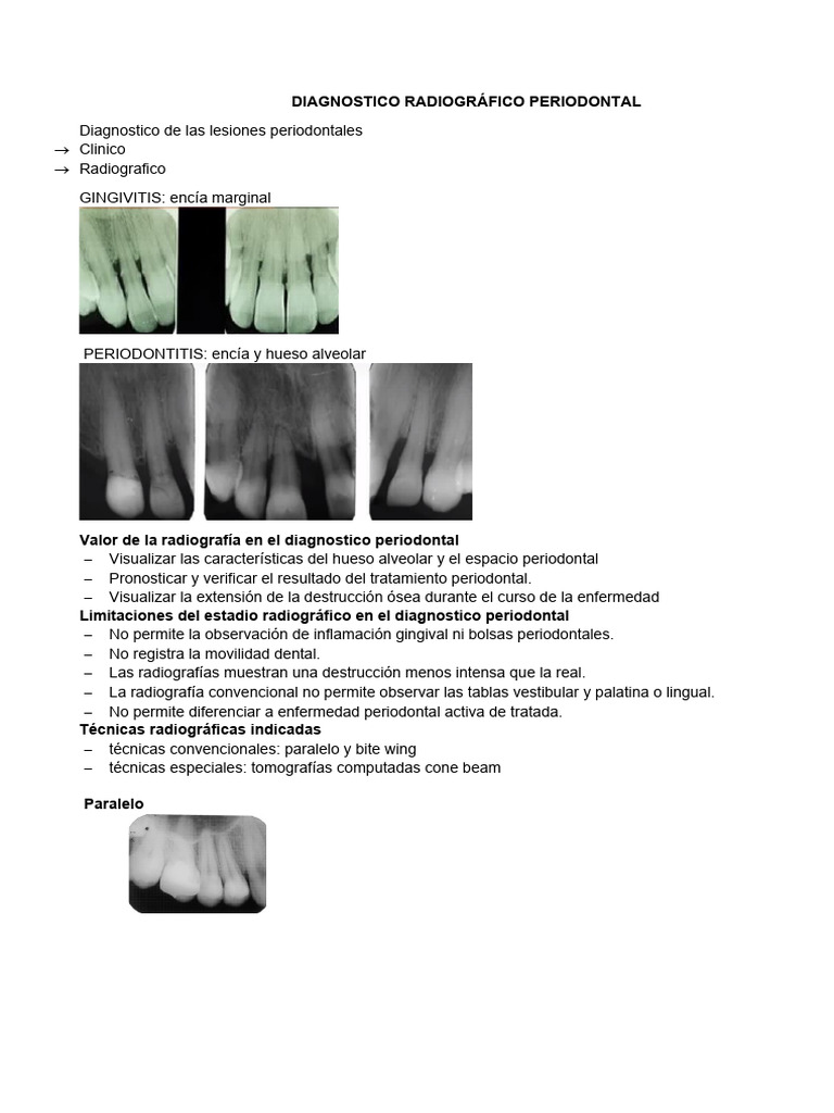 Diagnostico radiográfico periodontal | PDF | Hueso | Boca