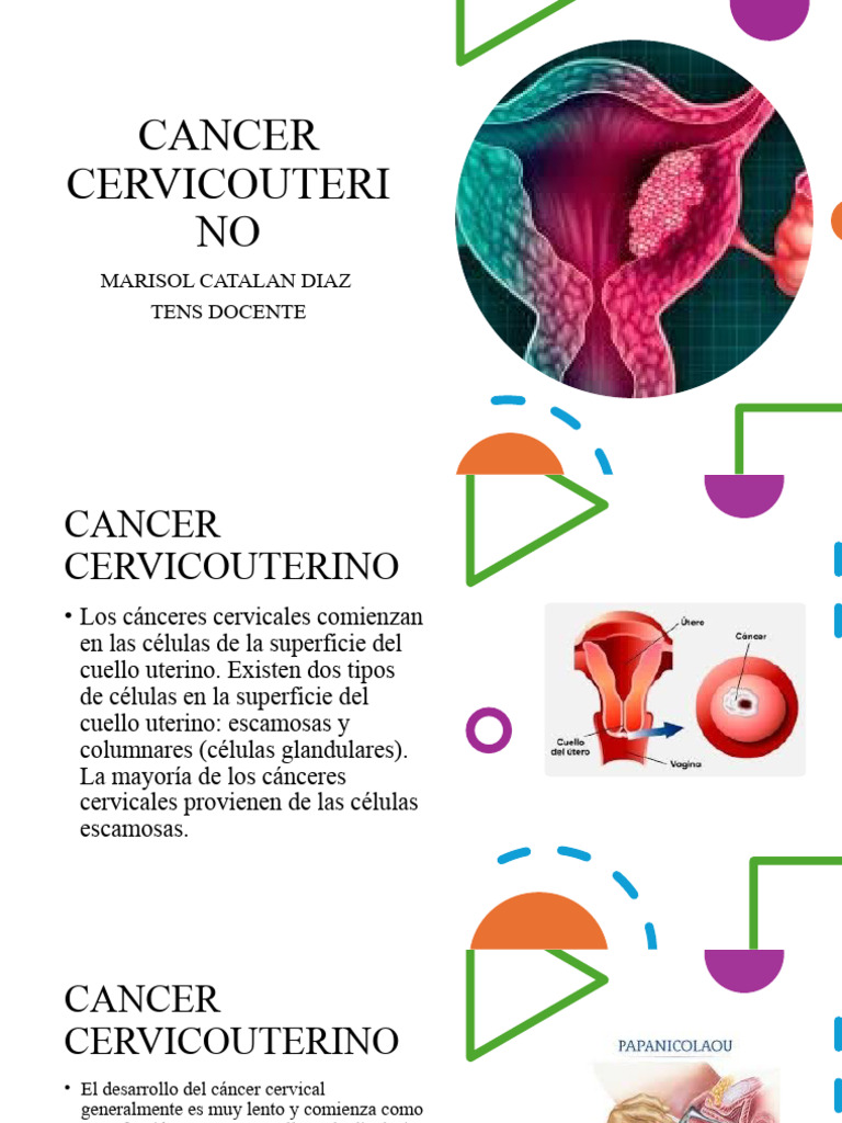 Cancer Cervicouterino | PDF | Cáncer de cuello uterino | Cáncer