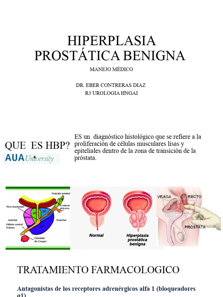 Hiperplasia de Próstata: Manejo Médico | PDF | Neuroquímica