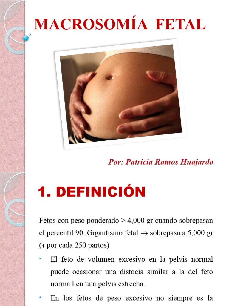Macrosomia Fetal | PDF