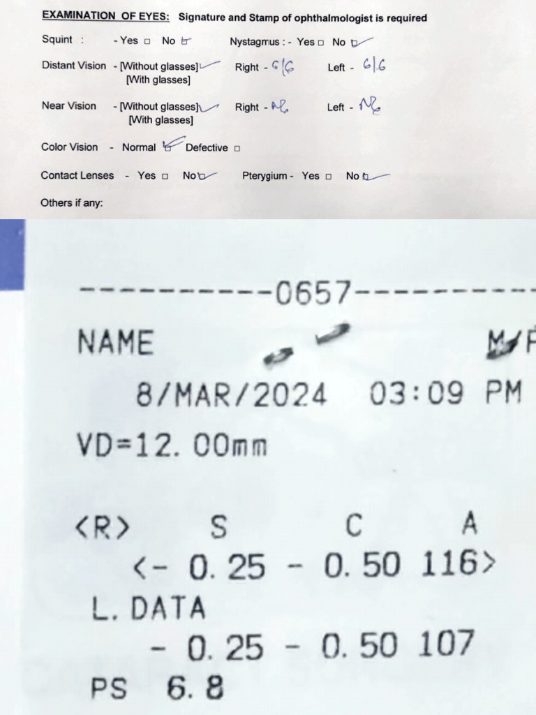 Dipak Patil Opthalmic Reports | PDF | Optics | Senses