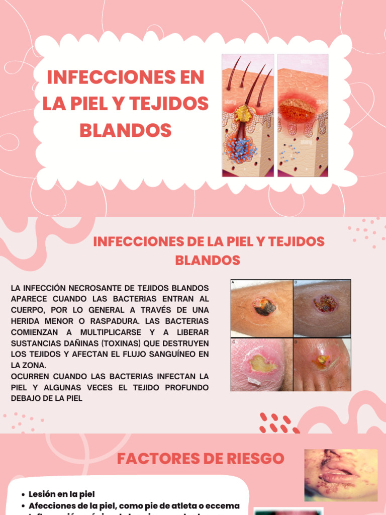 Infeccion de la piel y tejido Blando AJ-LA | PDF | Infección ...