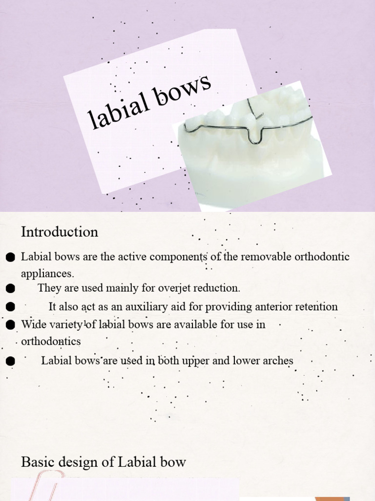 LABIAL BOW - PPTX - 20240327 - 231313 - 0000 | PDF | Orthodontics | Mouth