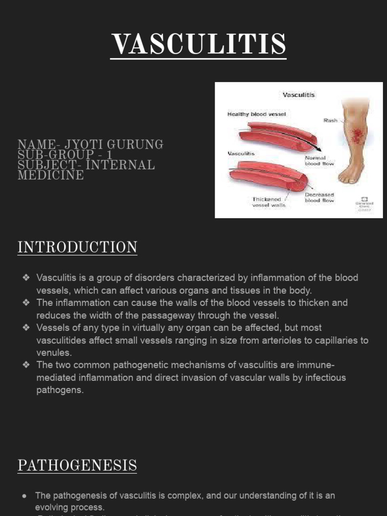 Jyoti Gurung Internal Vasculitis | PDF | Inflammation | Immunology