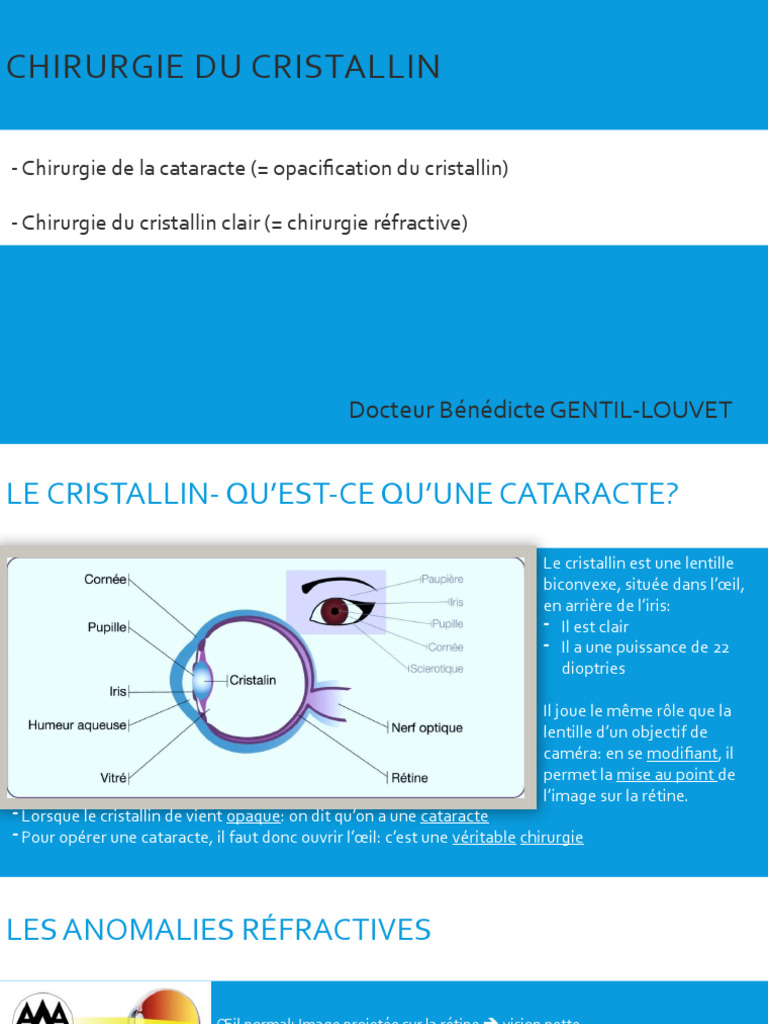 Chirurgie du cristallin : cataracte et implants | PDF | Cataracte | Œil ...