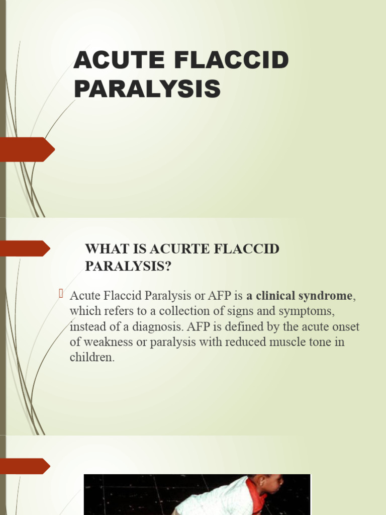 Acute Flaccid Paralysis | PDF