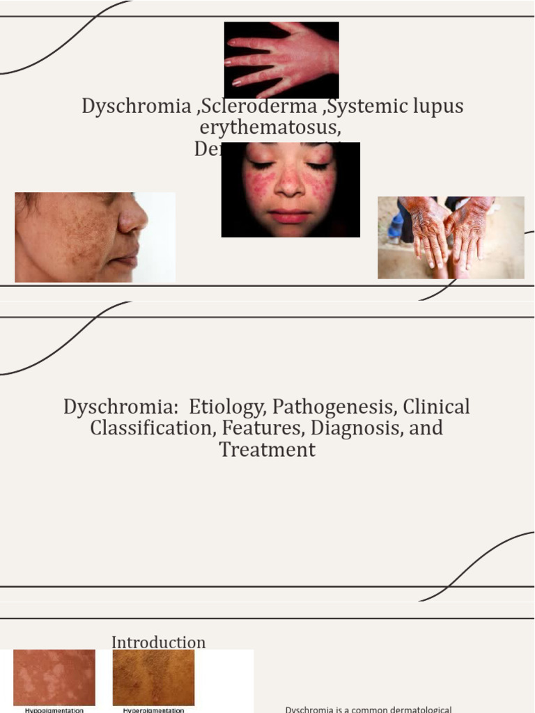 Dyschromia - by Gaurav Sharma and Shalini Saini | PDF | Autoimmune ...