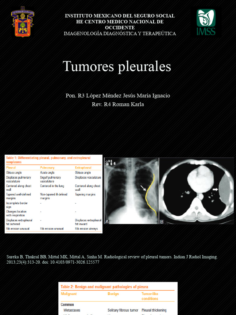 3. Tumores pleurales | PDF | Neoplasms | Fibers