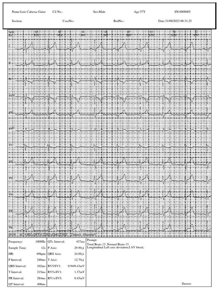 Ecg 1 | PDF