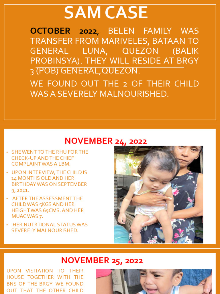 Sam Case | PDF | Malnutrition | Determinants Of Health