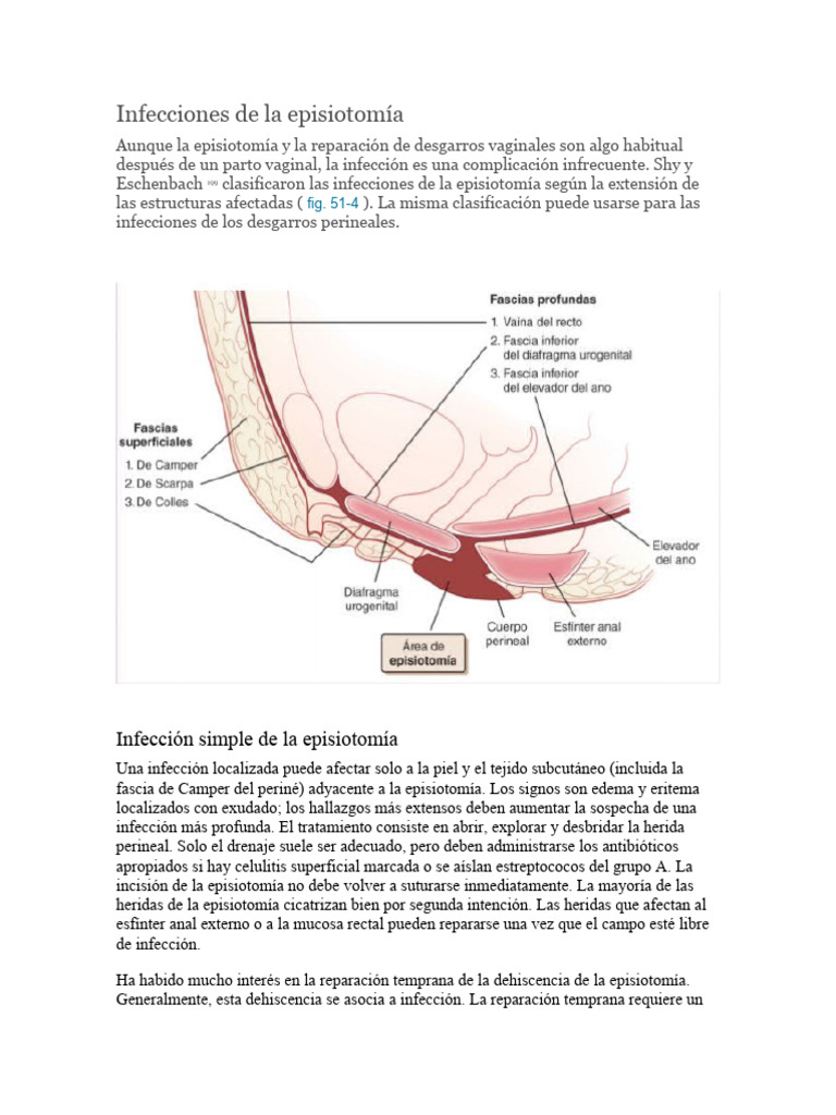 Infecciones de La Episiotomía | PDF | Especialidades Medicas | Medicina ...