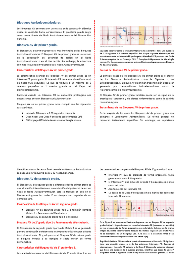 BAV y Taquiarritmias | PDF | Electrocardiografia | Arritmia cardiaca