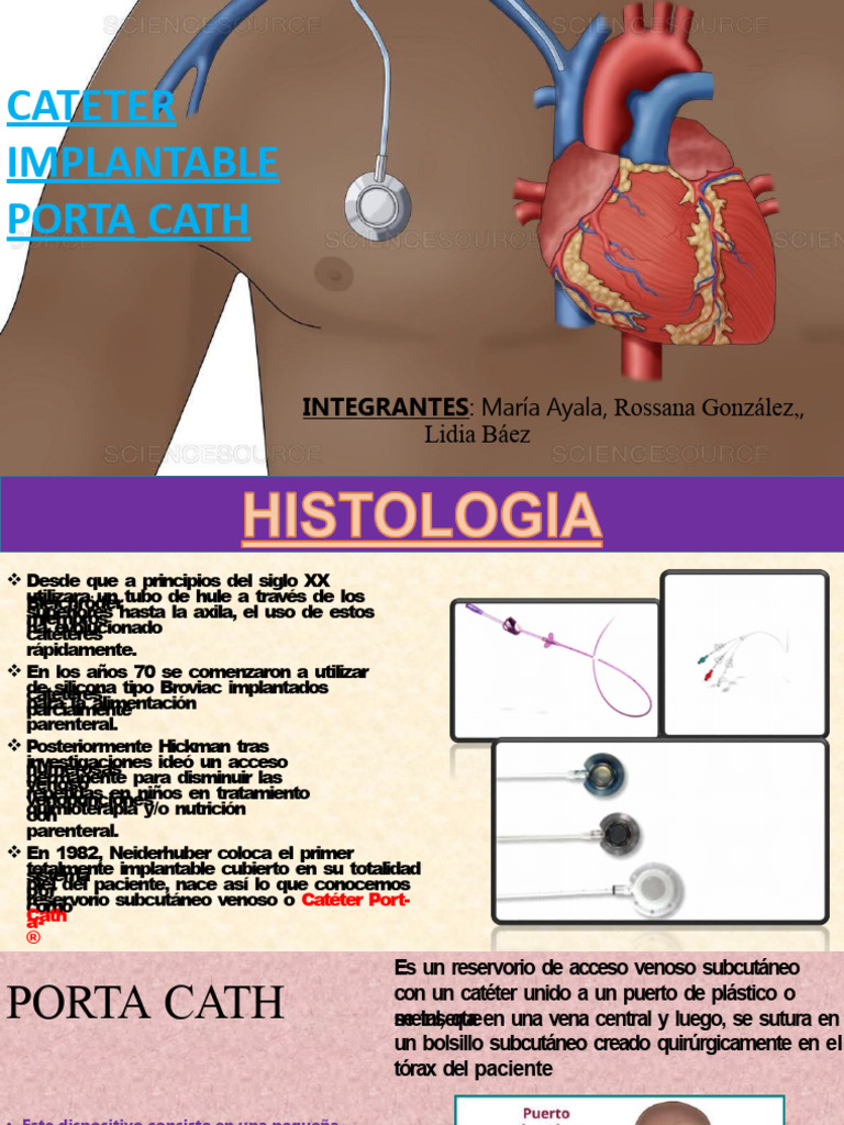 Cateter implantable Porta Cath | PDF | Medicina CLINICA ...