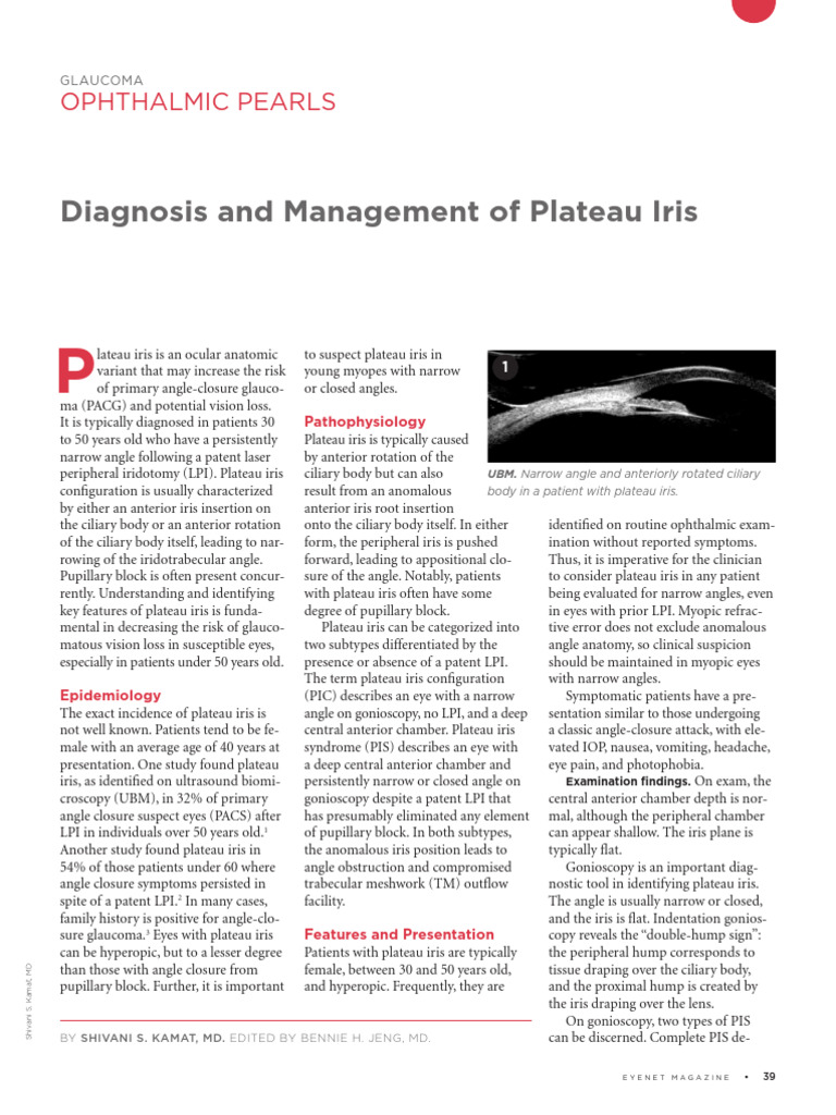 Iris Plateau September 2022 Ophthalmic Pearls | PDF | Glaucoma ...