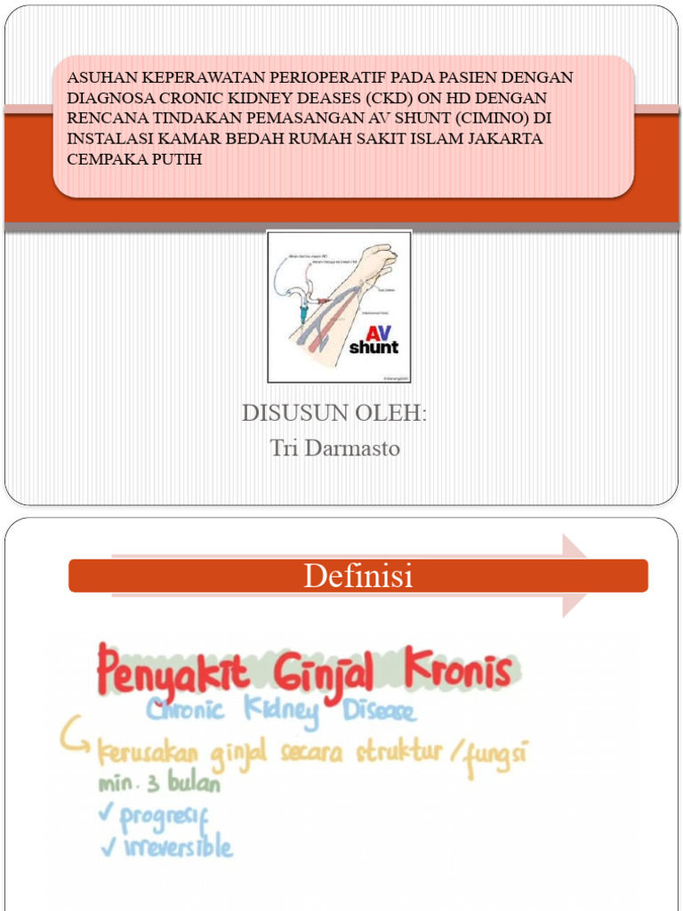 Tria AV Shunt Presentasi | PDF