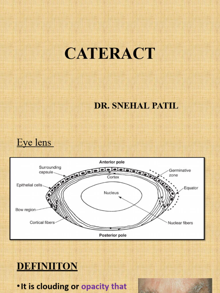 1 Cataract | PDF | Cataract | Facial Features