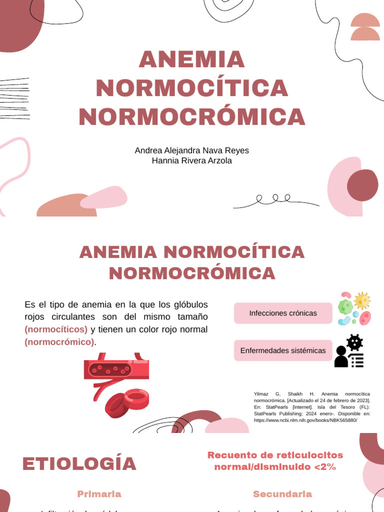 Anemia Normocítica Normocrómica: Guía Clínica | PDF | Anemia | Medicina ...