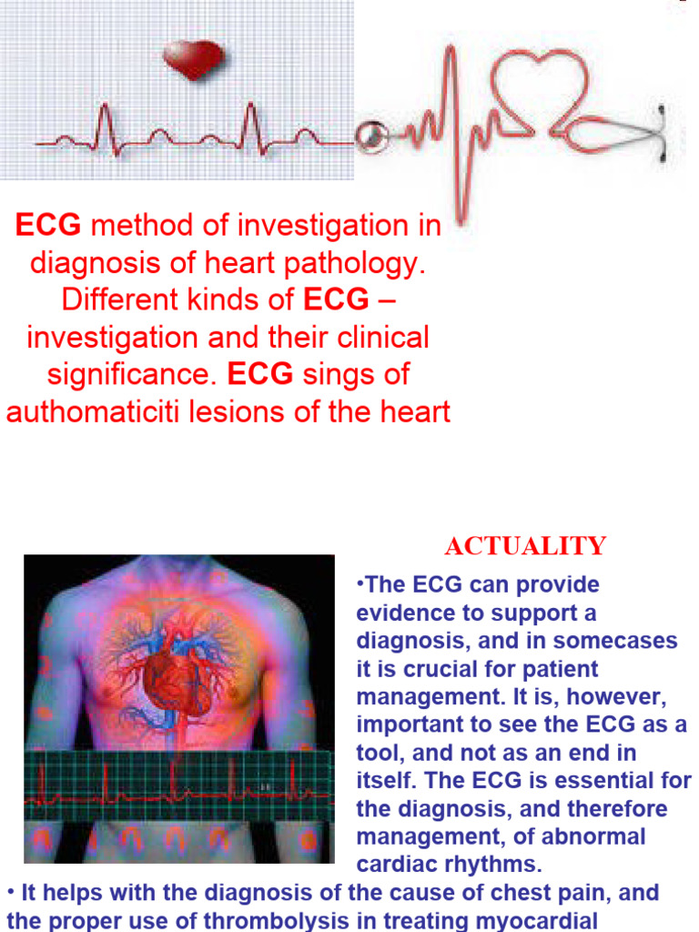 ECG 11 hik | PDF | Electrocardiography | Heart