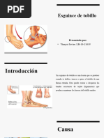 Proceso de Stieda y su tratamiento | PDF | Tobillo | Cirugía