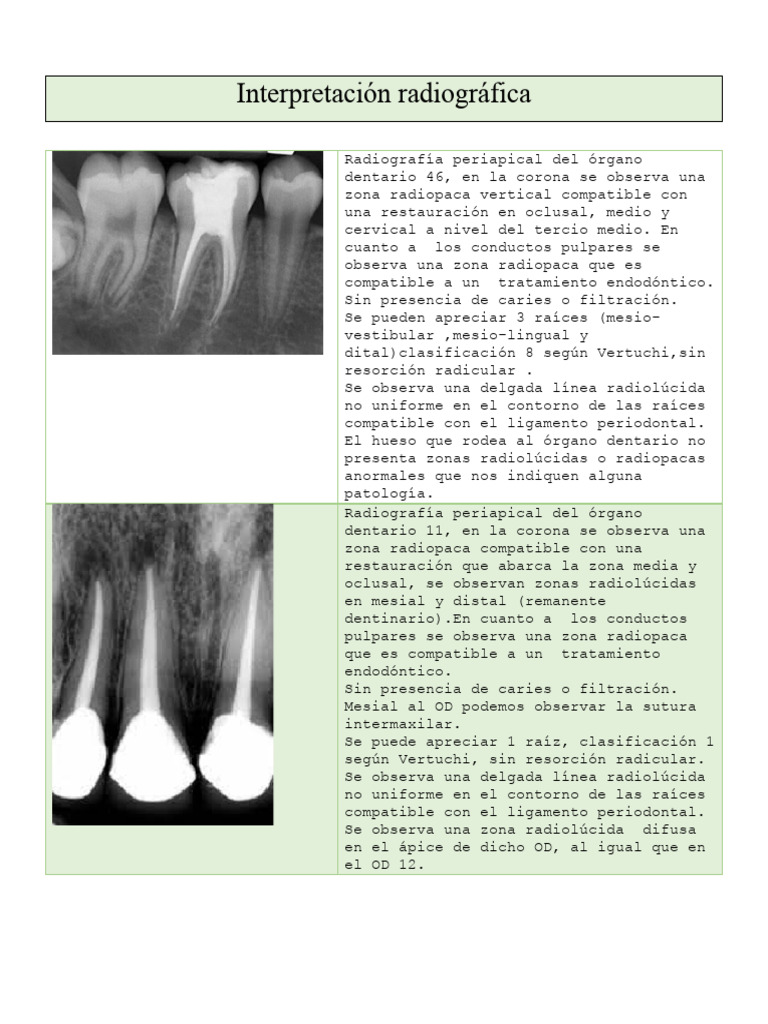 Análisis de Radiografías Periapicales Dentales | PDF | Raíz | Anatomia ...