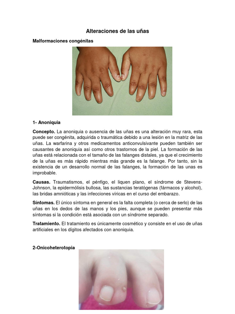 Alteraciones y malformaciones de uñas | PDF | Vitamina C | Clavo (anatomía)