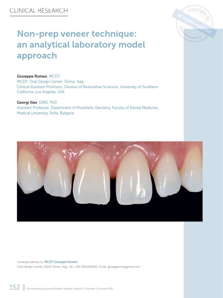 Non-Prep Veneer Technique - An Analytical Laboratory Model Approach ...
