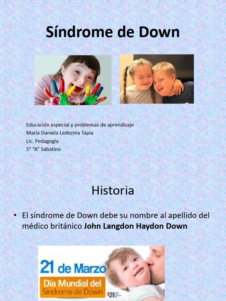 Sindrome de Down | PDF