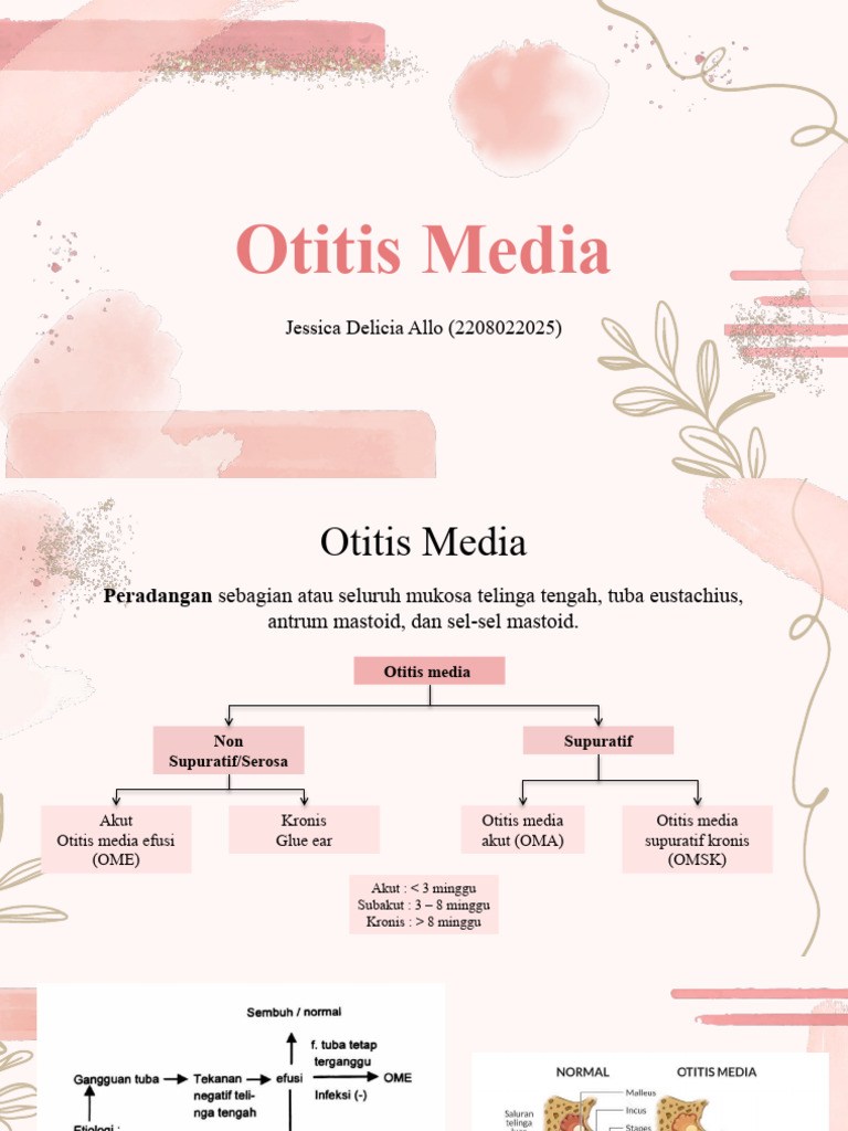 Otitis Media 2 | PDF