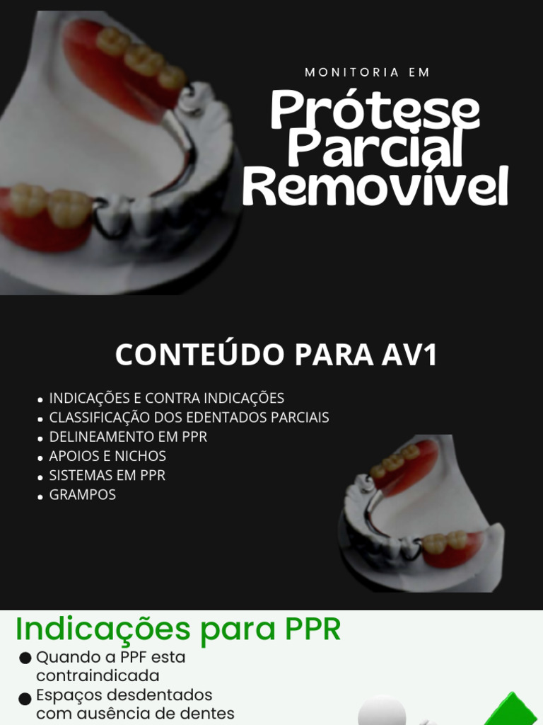 Indicações e Contraindicações de PPR | PDF | Dente humano | Prótese