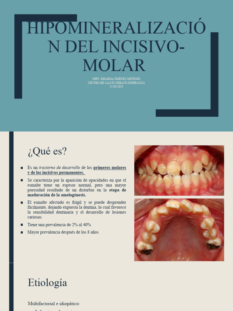HIPOMINERALIZACIÓN DEL INCISIVO-MOLAR | PDF | Especialidades Medicas ...
