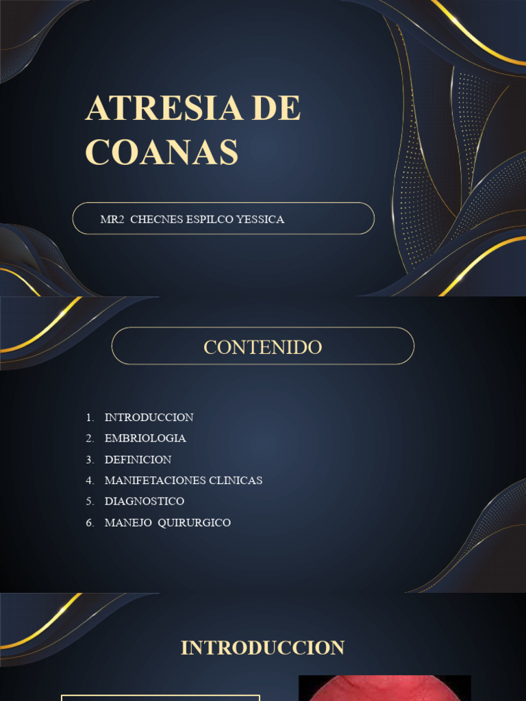 Atresia de Coanas | Descargar gratis PDF | Medicina CLINICA ...